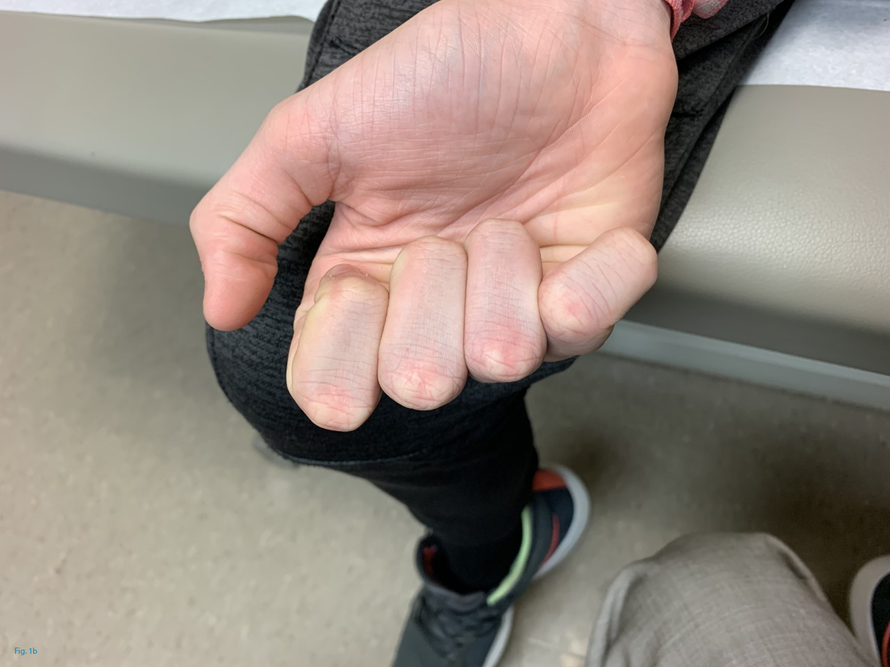 Clinical Photography Is a ‘Snap’ to Implement