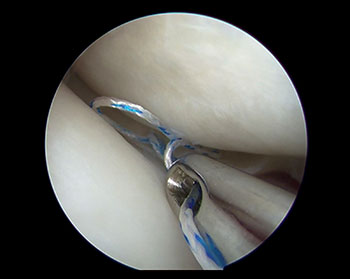 Newsroom - American Academy of Orthopaedic Surgeons